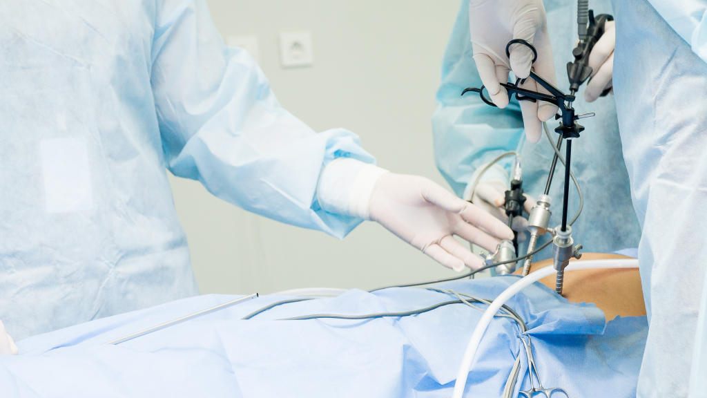 Laparoscopy Surgery - IN Surgery